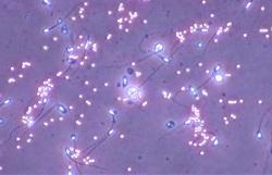 Mar Test | CHU clermont-ferrand