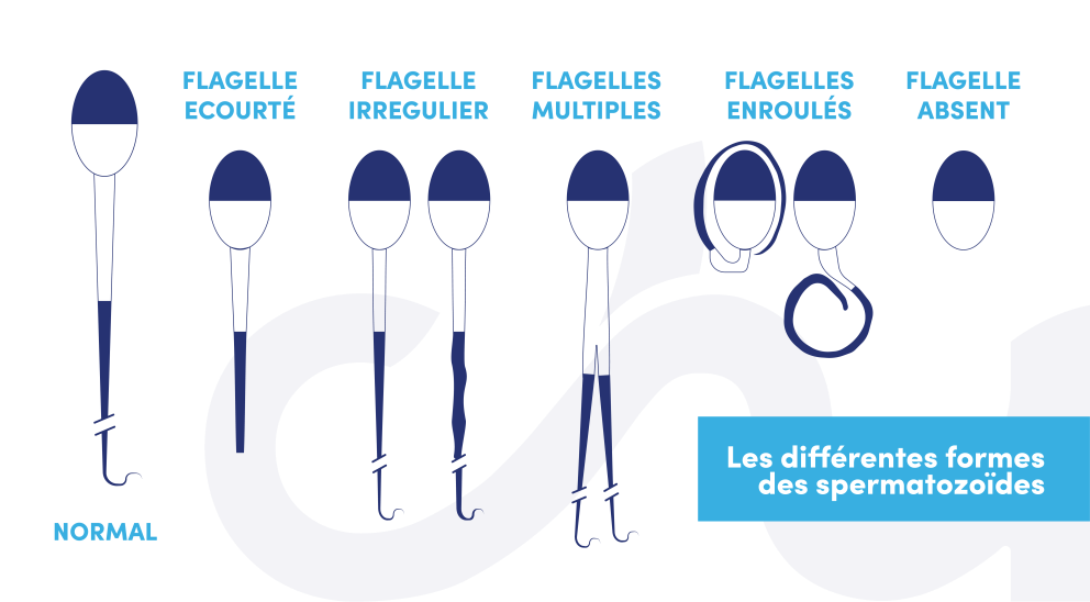 Spermogramme / Spermoculture | CHU clermont-ferrand